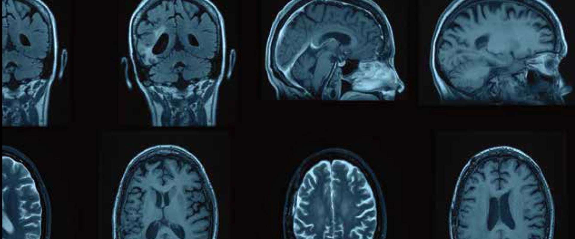 Understanding Nuclear Medicine Imaging and Its Safety Implications